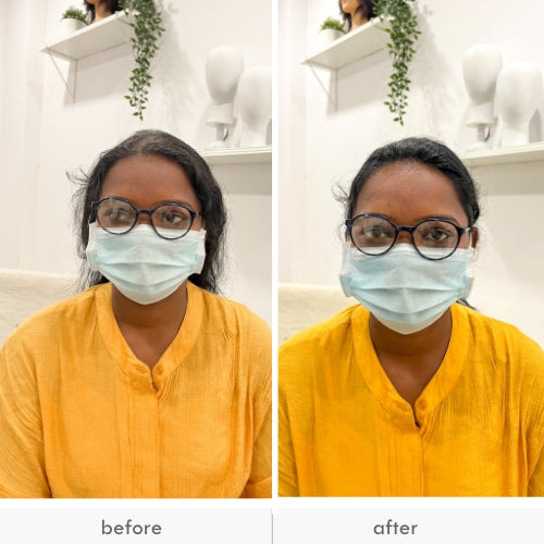 Buy 2" Invisible Push Up Hair Patch Online For Fuller Look